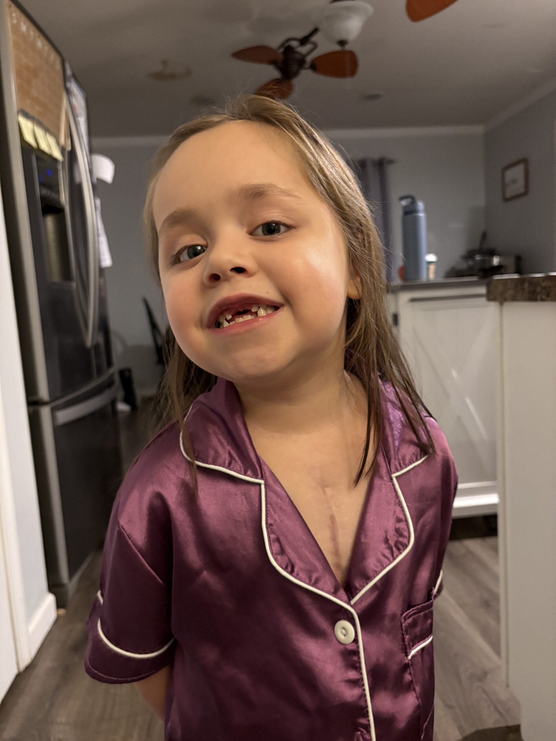 Ela Update: Heart Transplant Rejection 3/10/26 - COTA for Gabriela's ...