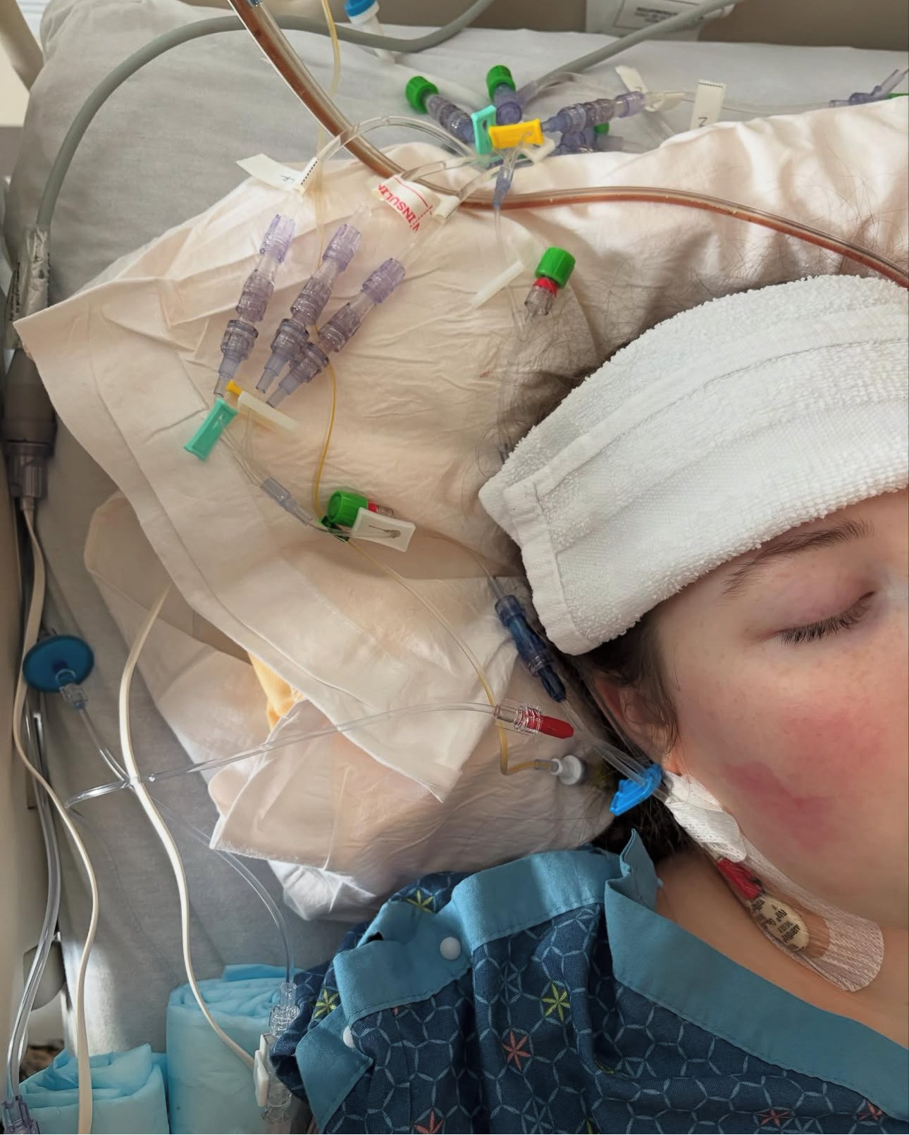 Post-Op, Day 1 - COTA for Gillian's TPIAT