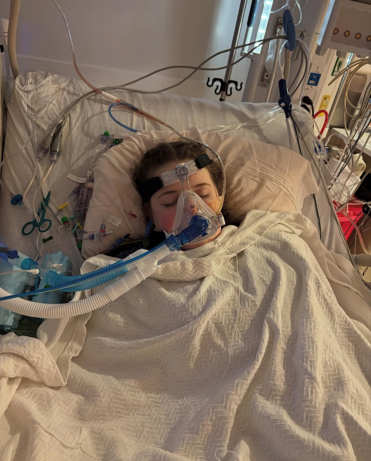 Post-Op, Day 2 - Flash Pulmonary Edema - COTA for Gillian's TPIAT