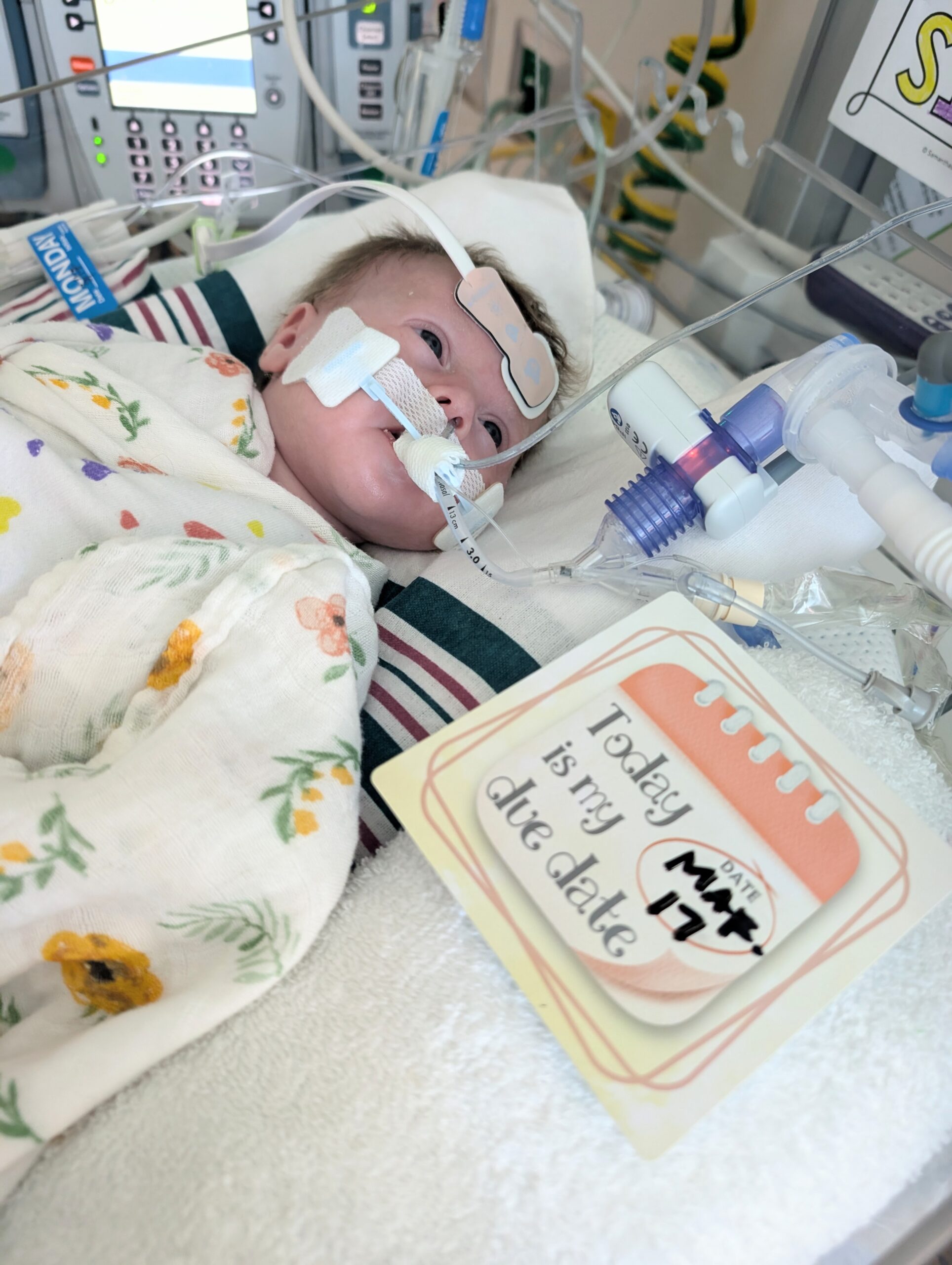 Transplant List - COTA for Team Cali