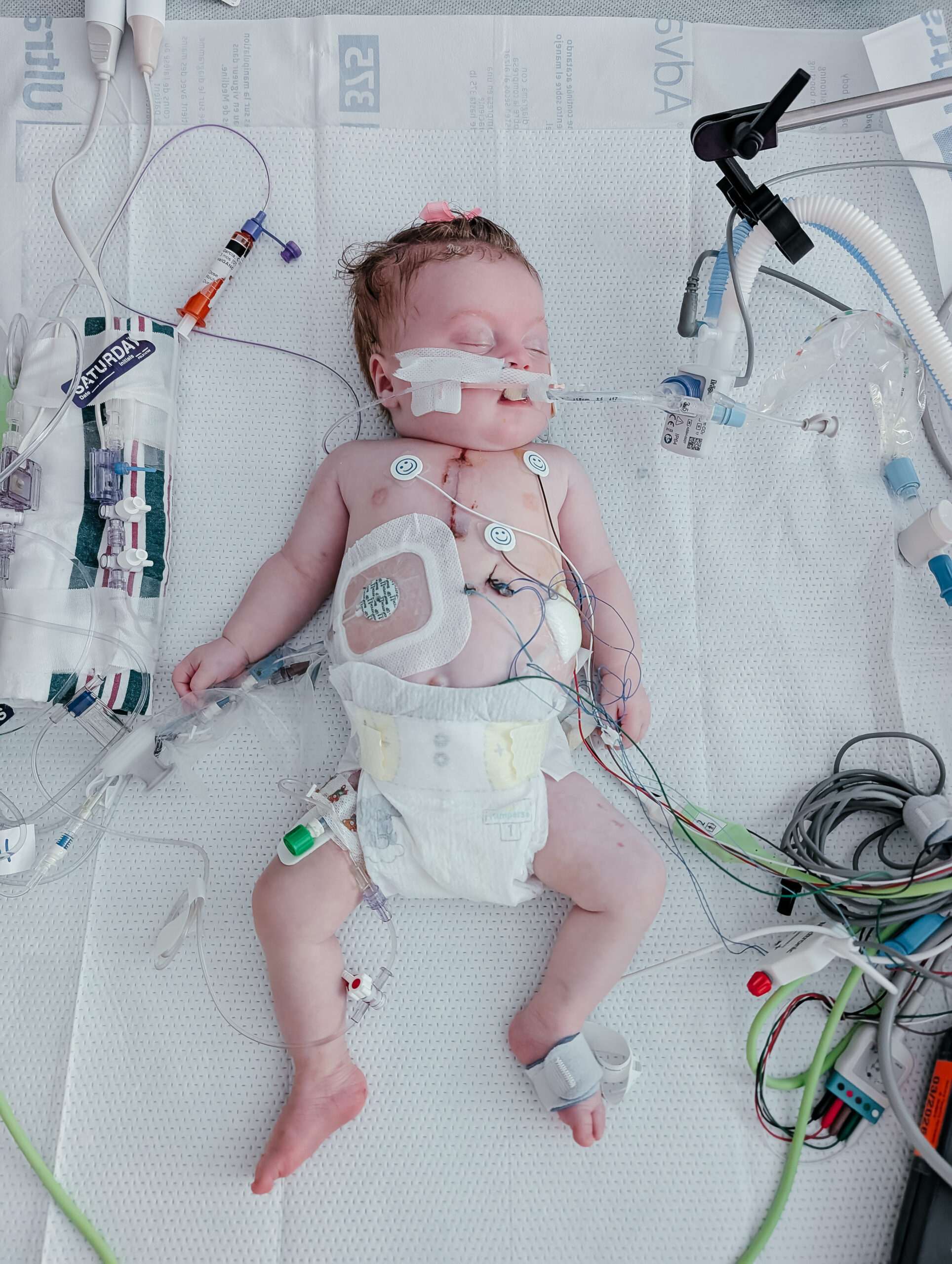 Post Transplant - Day 14 - COTA for Team Cali