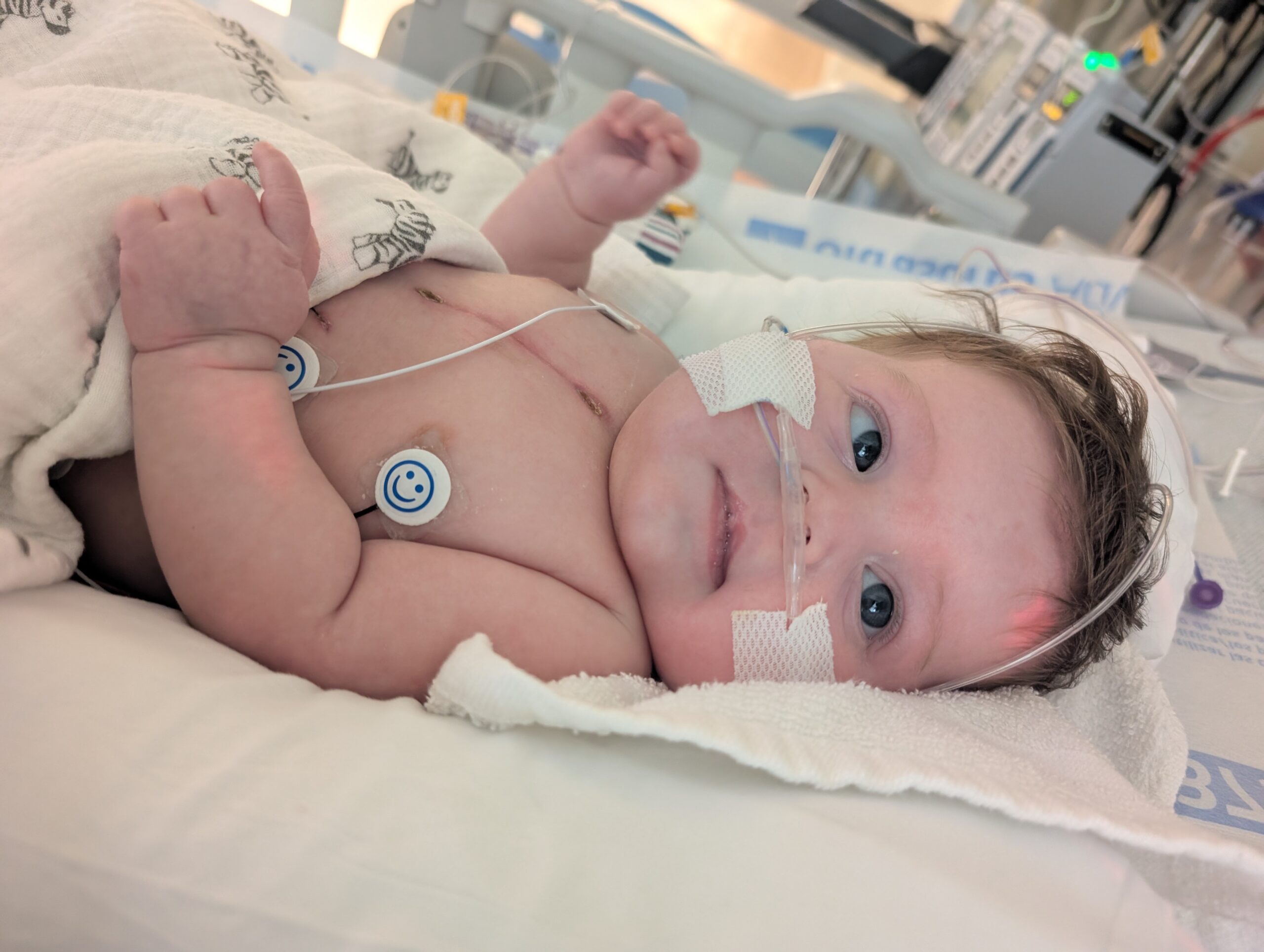 Post Transplant - Day 31 (CCU) - COTA for Team Cali