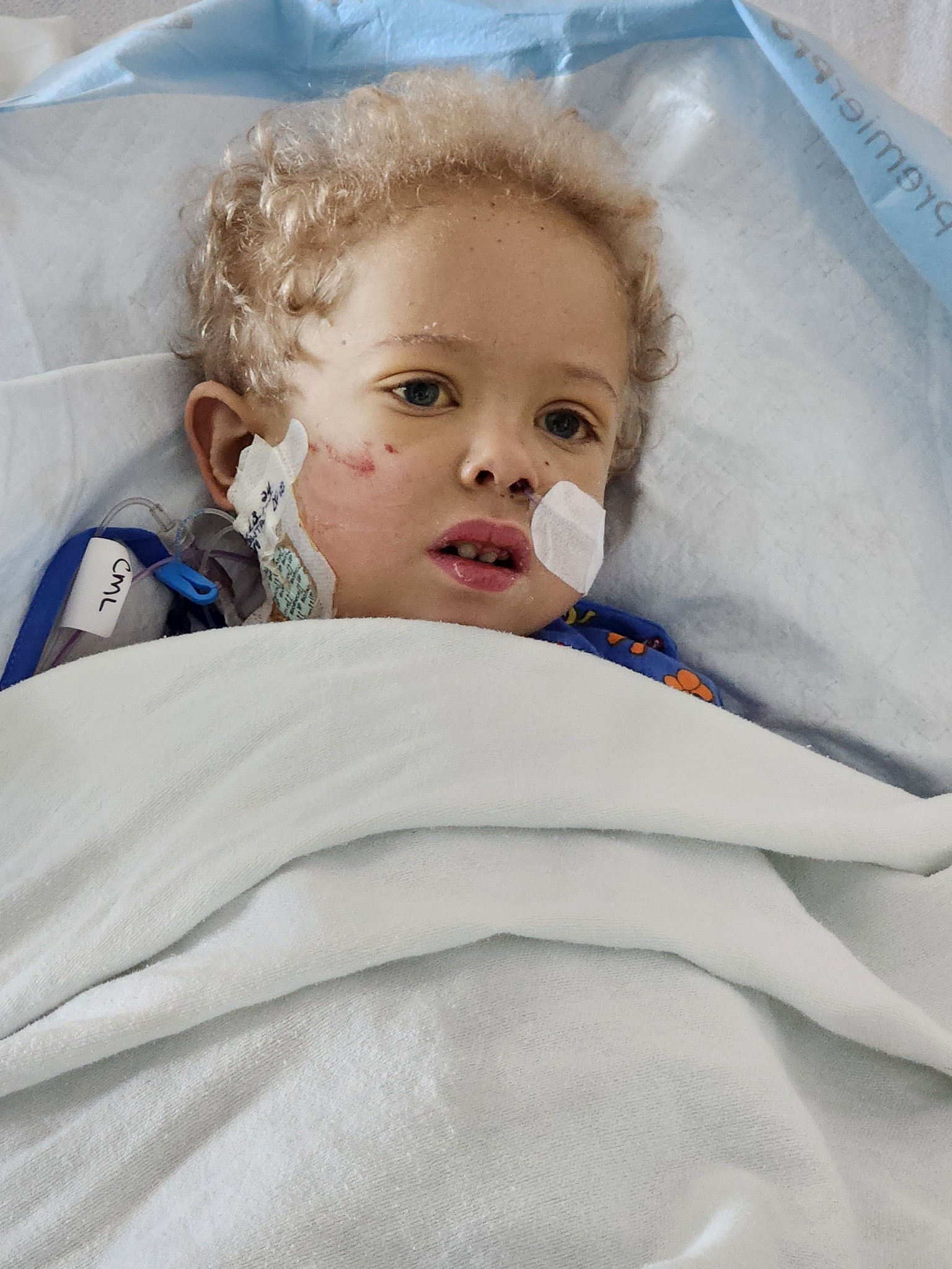 Winston- Day 6 after surgery! – COTA for Team Winston